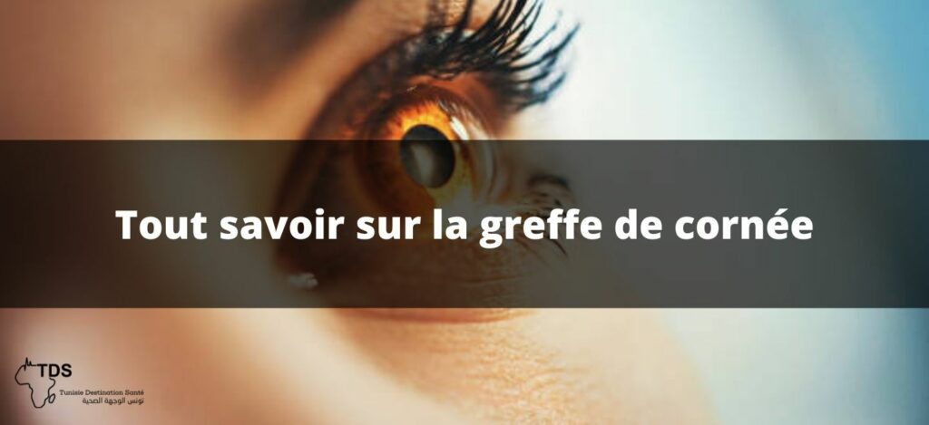 Greffe de Cornée : Restauration de la Vision et Traitements