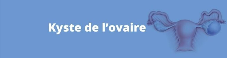 Kyste de l'ovaire : Kyste ovarien, intervention gynécologie