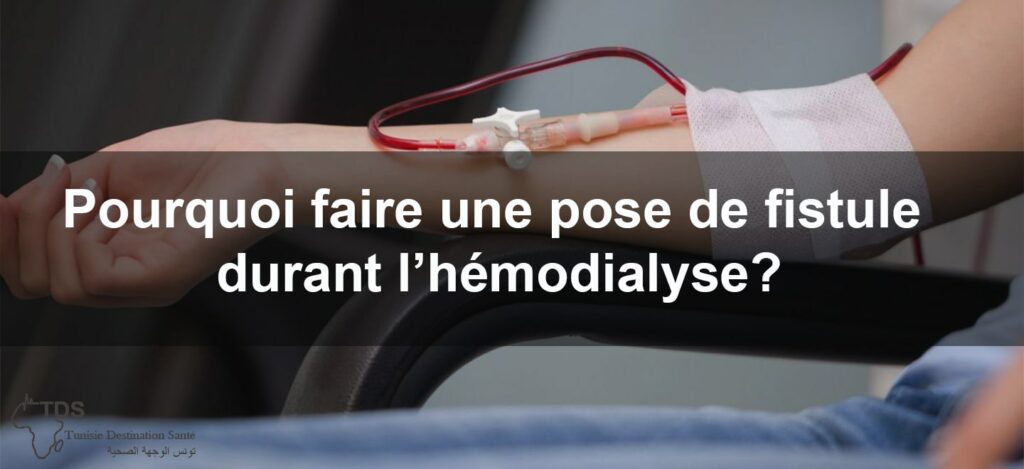 Comment Se Passe L’Hémodialyse – YXCKKF