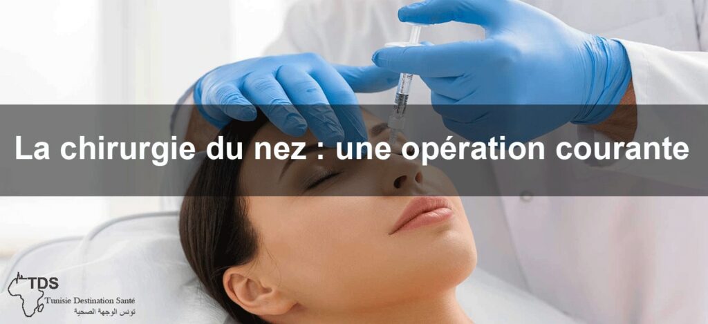 chirurgie du nez : Procédure courante et résultats esthétiques