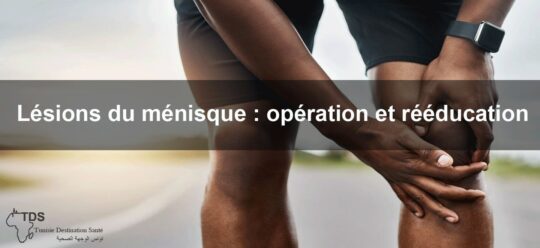 Lésions du ménisque : Chirurgie et rééducation