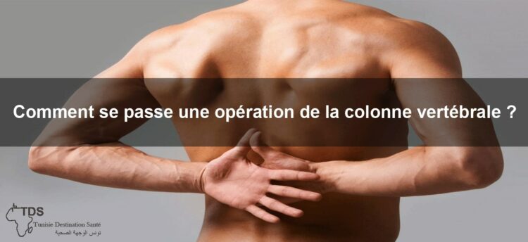 Opération de la colonne vertébrale : Déroulement simplifié