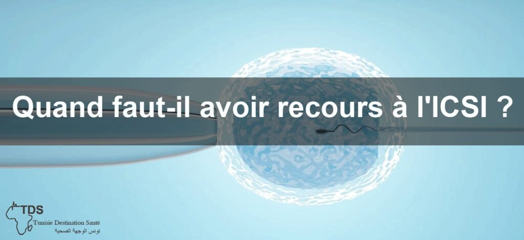 ICSI : Indications et moment propice pour la fertilisation assistée