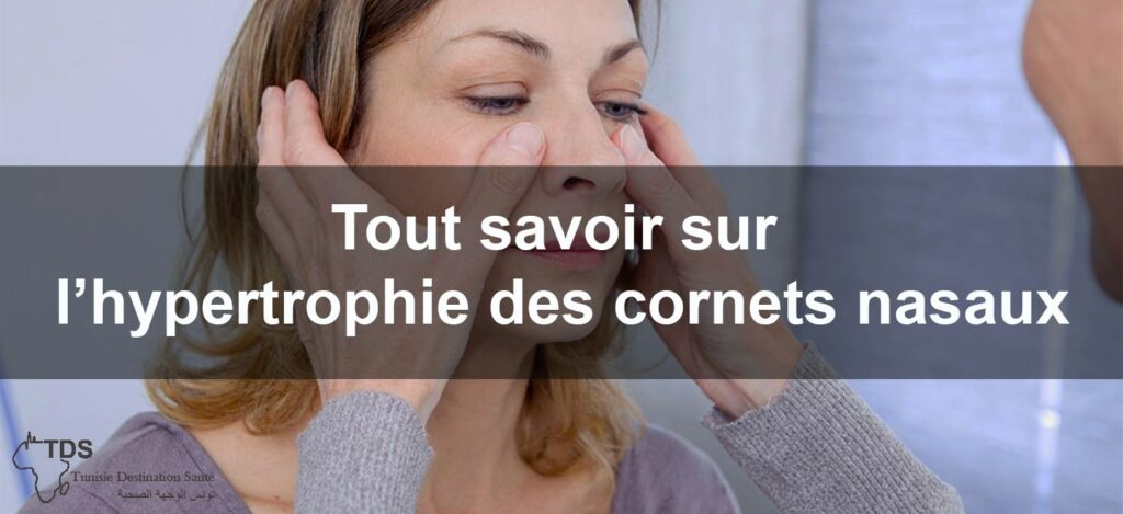 Cornets Nasaux : causes, symptômes et traitements