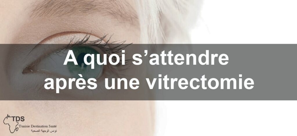 Vitrectomie : Chirurgie, rétablissement, taux de réussite