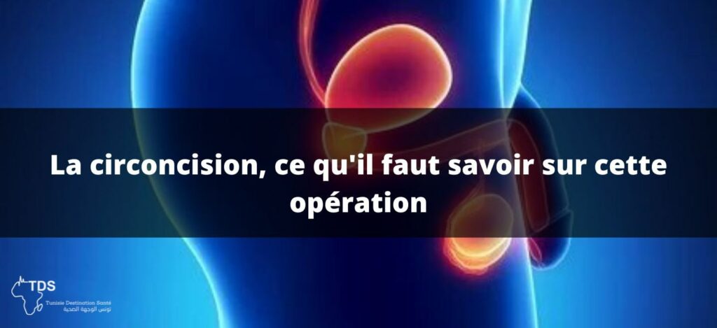 Circoncision : tout savoir sur l'opération et ses effets sur la santé