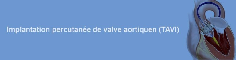 TAVI : Implantation percutanée de valve aortique