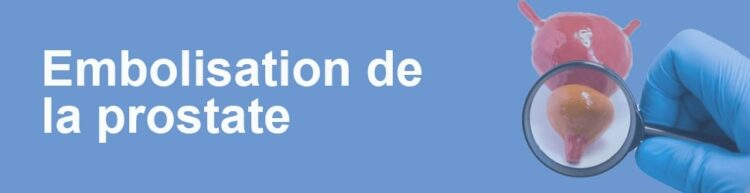 Embolisation prostatique: techniques, trucs et astuces