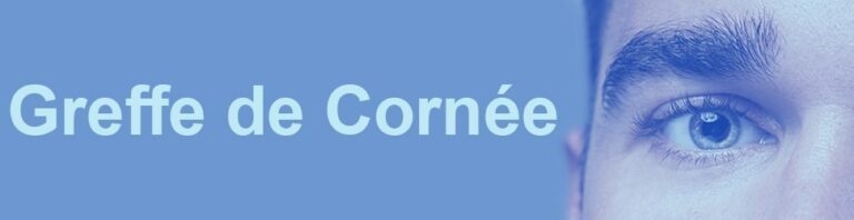 Greffe de Cornée : Procédure, Prix et Résultats